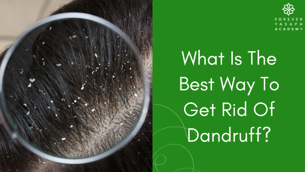 What is The Best Way To Get Rid of Dandruff? - Forever Yasaph Academy